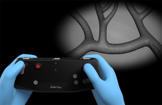 Microbot says Liberty robotic surgical system ready for human trials