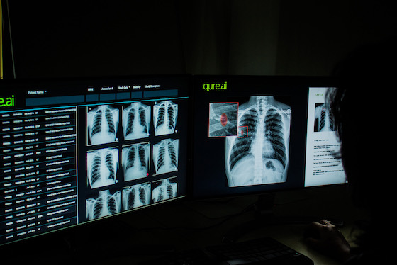 Qure.ai integrates with deepc for AI-enhanced patient care workflows