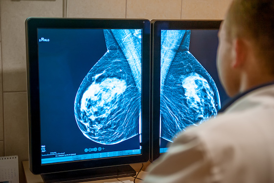 Tempus AI and Stemline partner to bridge critical gap in breast cancer care