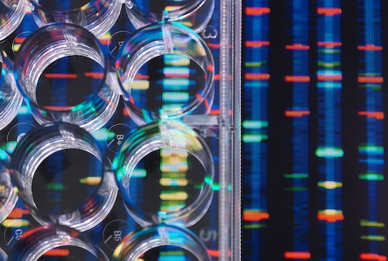 First bespoke CRISPR therapy treats infant with rare metabolic disorder