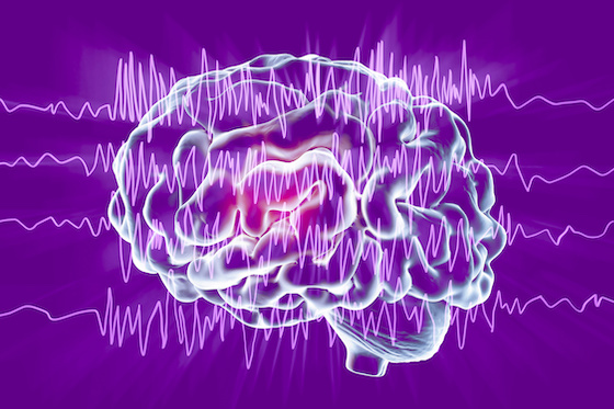 Empatica to launch study for AI-based seizure forecasting