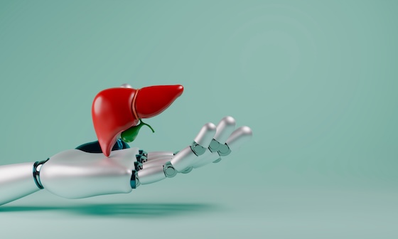 EU accepts use of AI tool that could fast track new MASH therapies