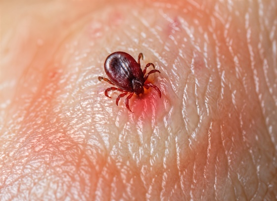 Third booster of Pfizer, Valneva's Lyme shot shows sustained immune ...