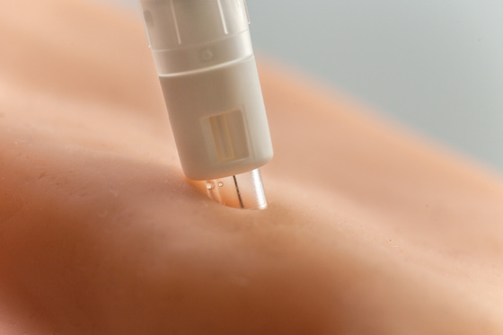 Lilly buddies up with Elektrofi on subcutaneous delivery of biologics