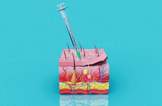 AstraZeneca's Saphnelo succeeds in Phase III as self-injectable lupus ...